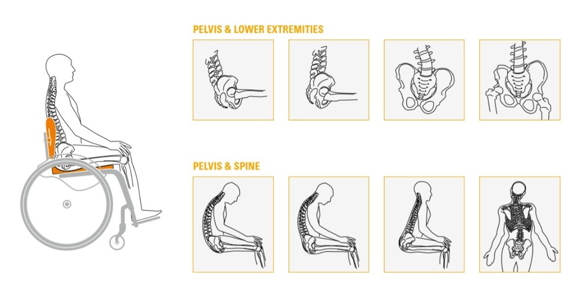 Pelvic & Spinal Postures | Sunrise Medical